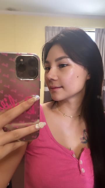 #分享 隆鼻分享 - 醫美板 | Dcard