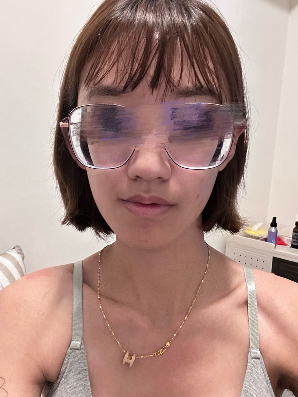 #詢問 頰凹求解！ - 醫美板 | Dcard