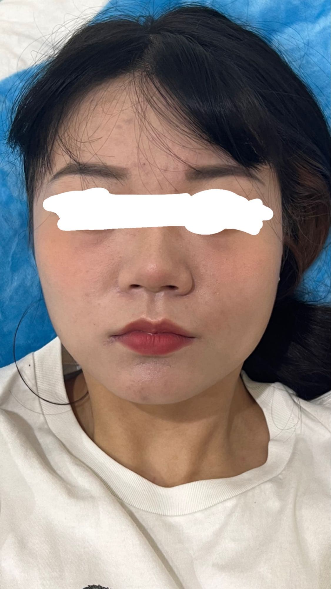 臉不對稱 脖子歪 求🥹🥹 - 心情板 | Dcard