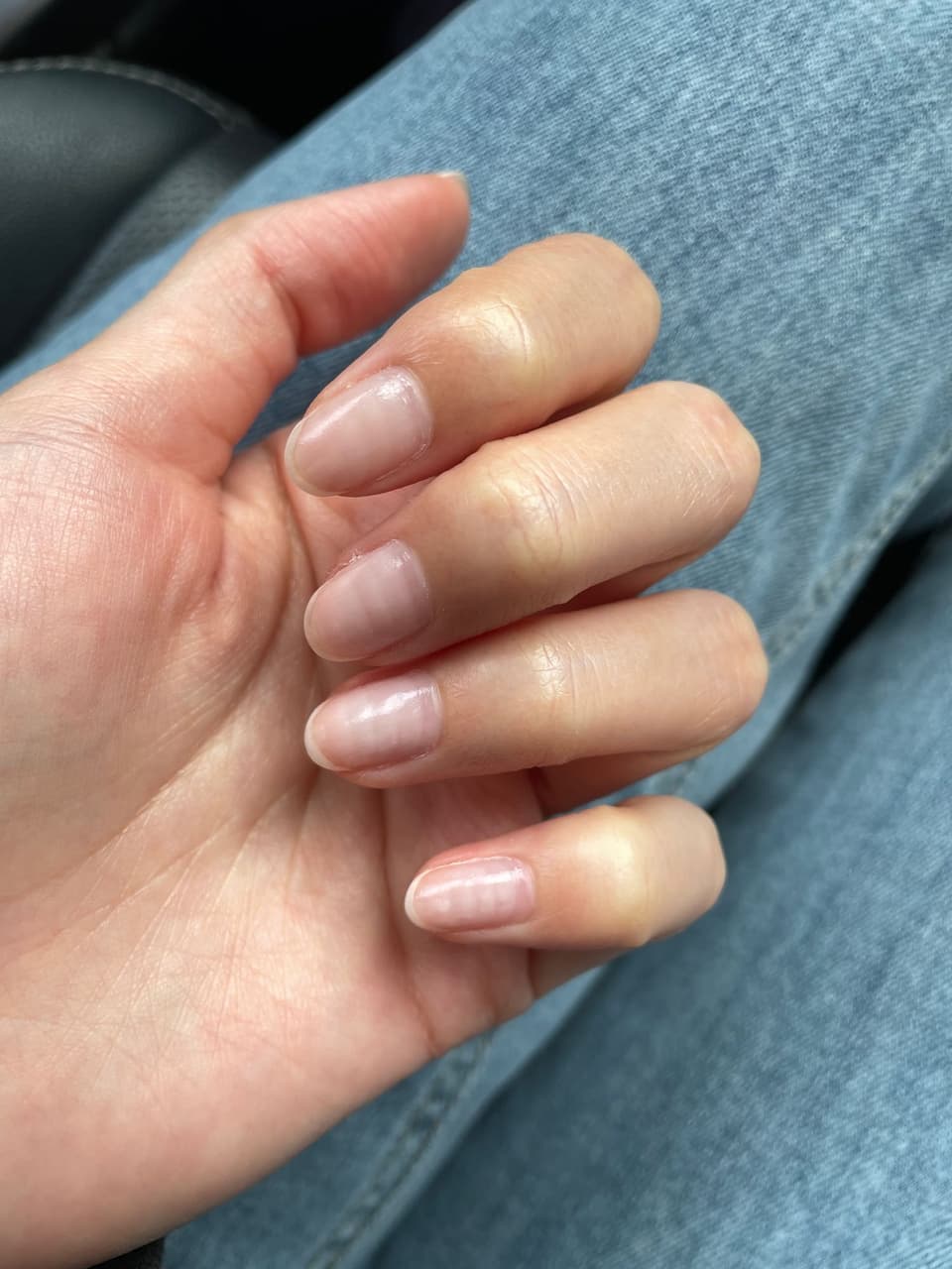 問題 卸甲後這樣是正常的嗎 美甲板 Dcard