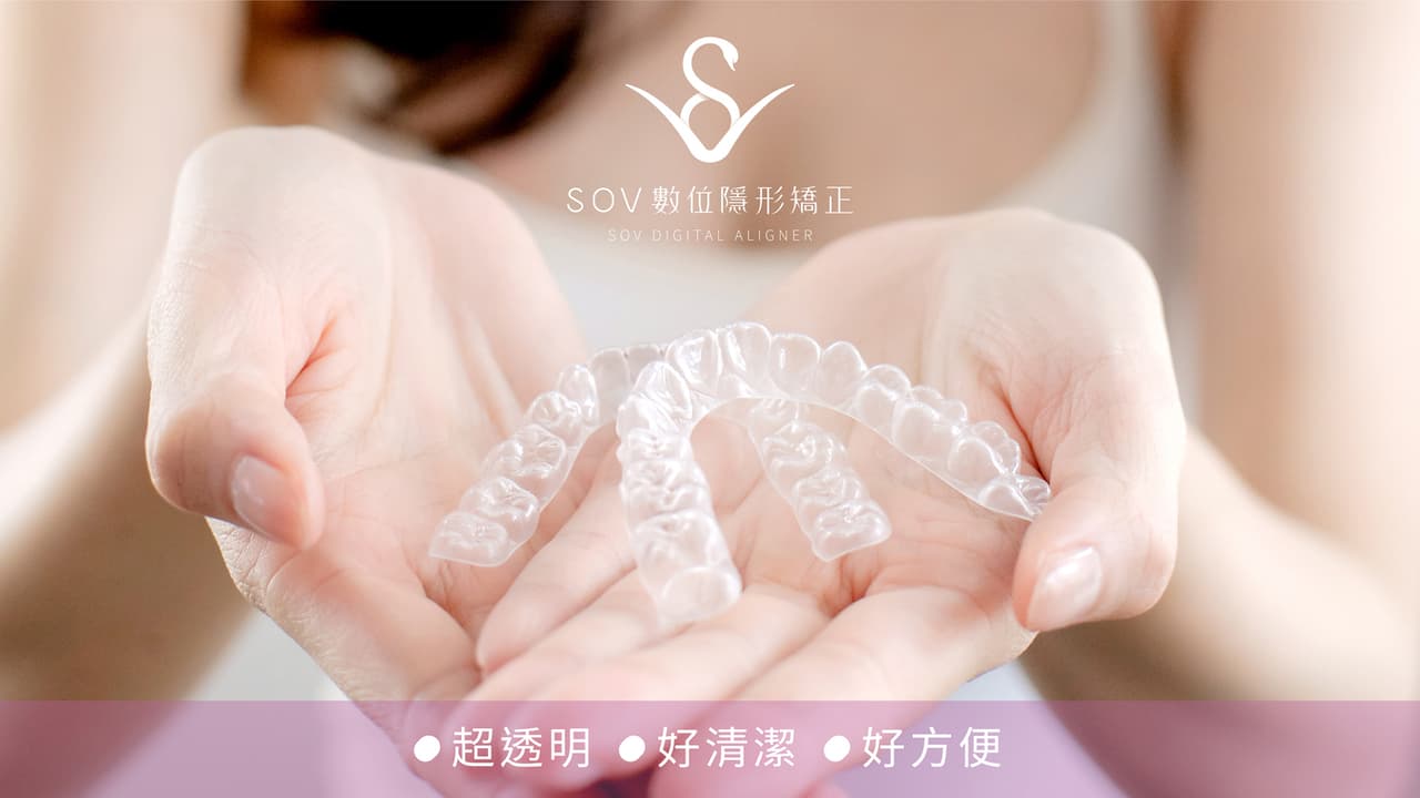 SOV X Dcard 隱形牙套體驗日 - 牙齒矯正板 | Dcard