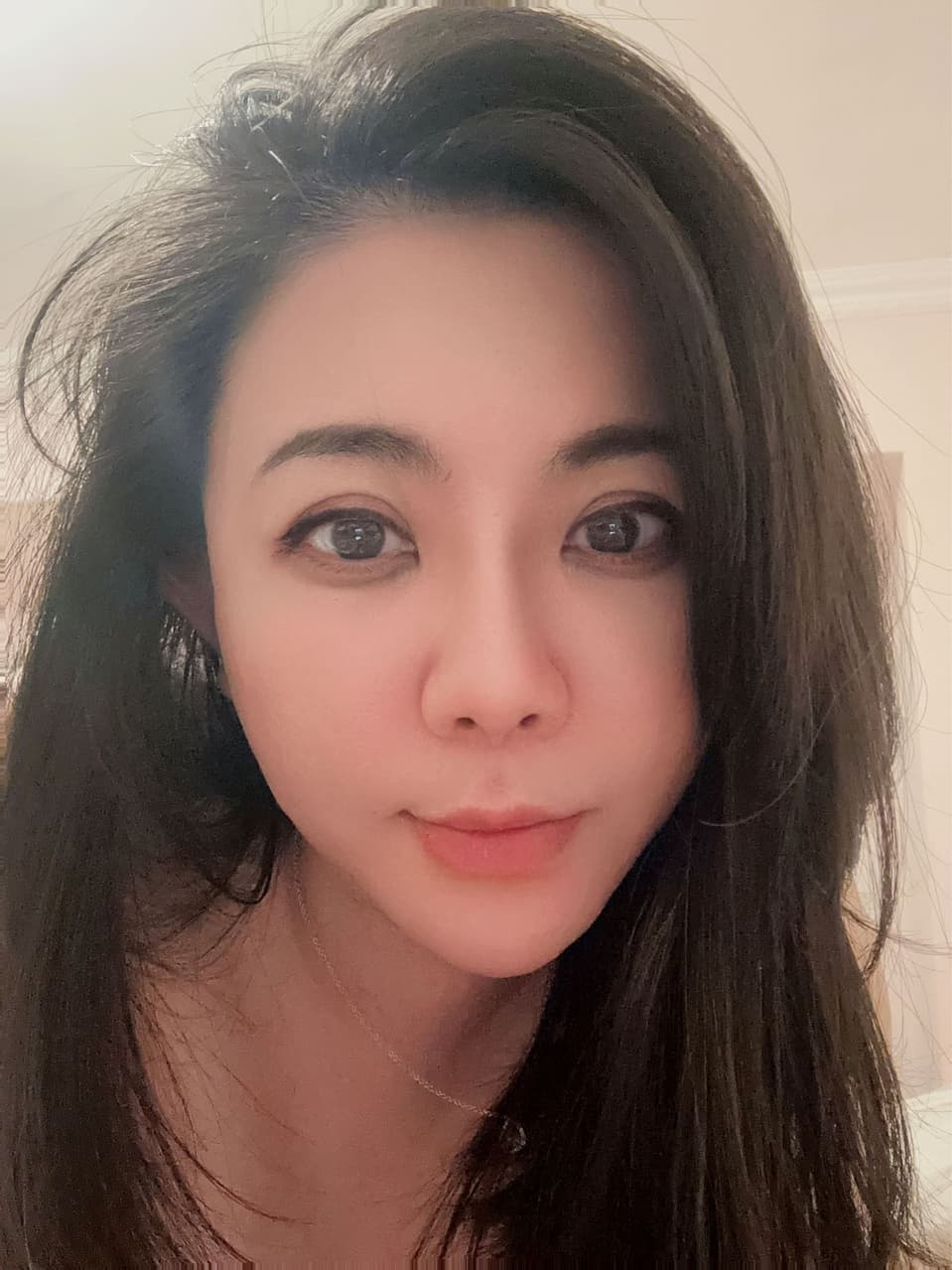 #分享 縮人中減齡手術🫶🏻 - 醫美板 | Dcard