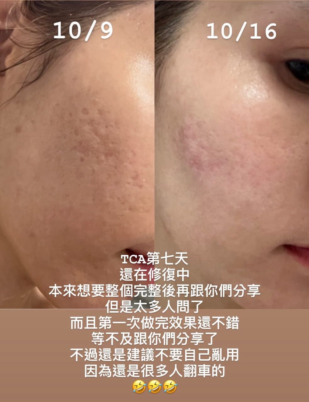 #活動 分享 ｜ 千萬不要自己隨便的做T CA - 美妝板 | Dcard