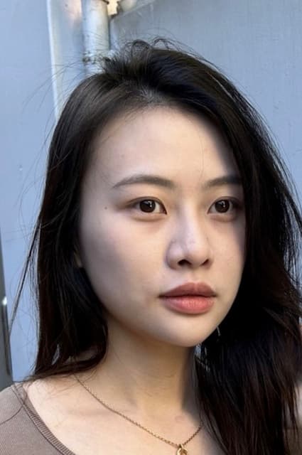 #分享 玻尿酸下巴 拍照終於不用喬角度了! - 醫美板 | Dcard