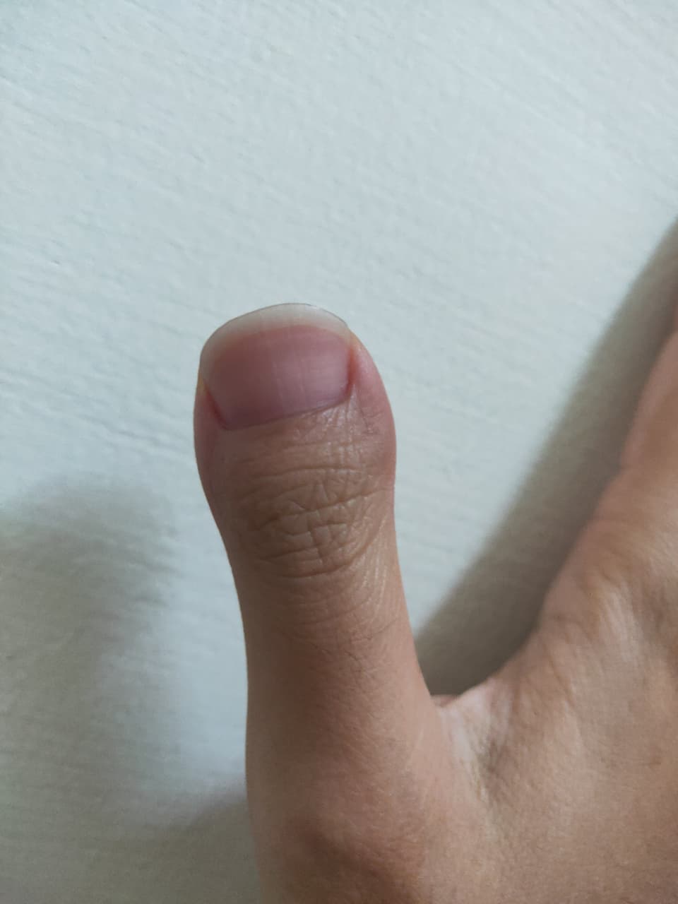問題 有適合短指症的穿戴甲嗎? 美甲板 Dcard