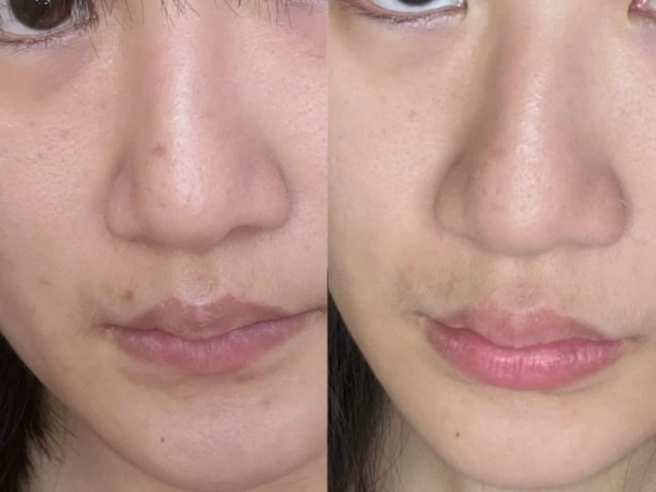 #分享 痘疤人2款美白！倩碧淡斑、妮維雅L630綠管 - 美妝板 | Dcard