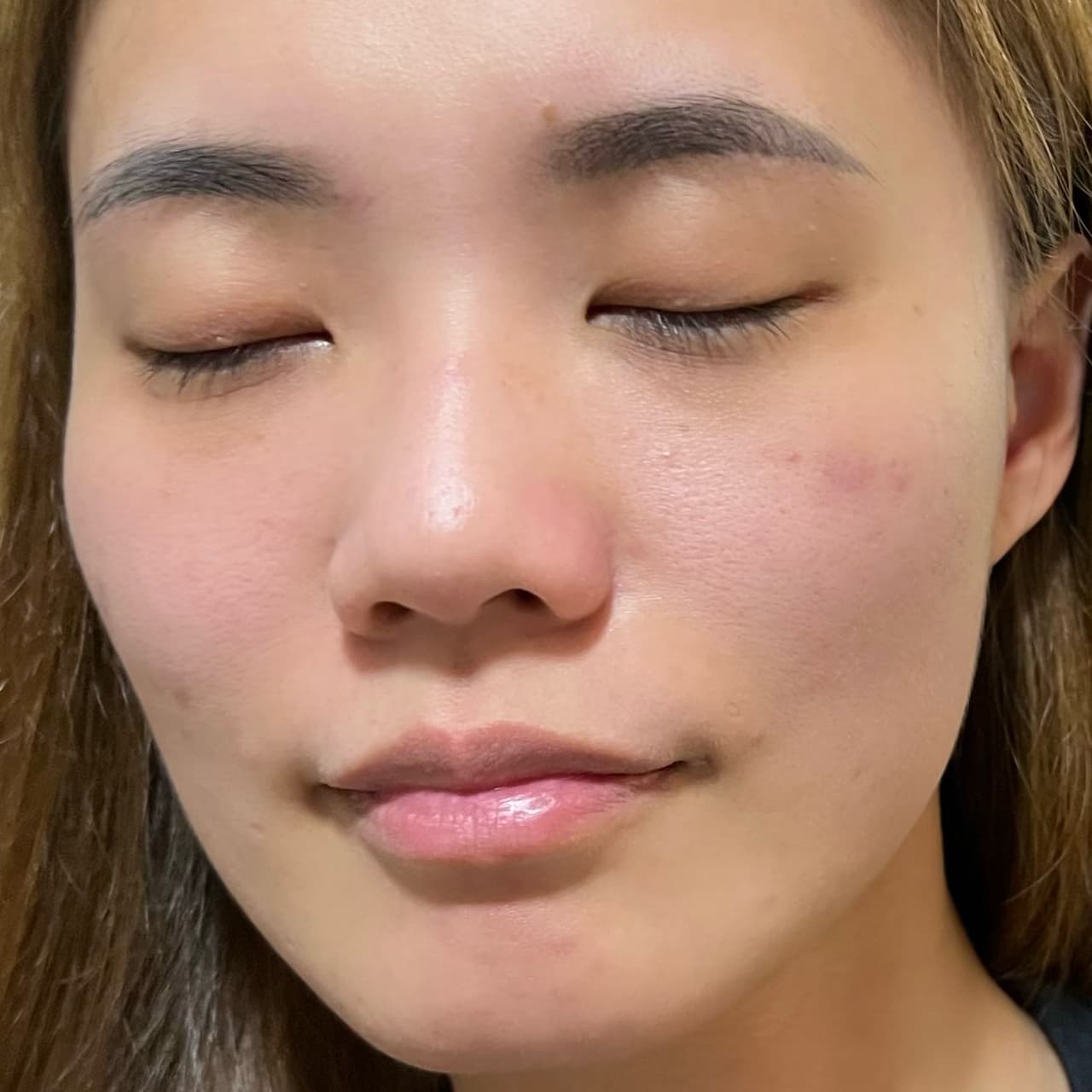 無痛跟粉刺說掰掰 ft.CNP Laboratory - 芮妮是我🎈 (@chw98) | Dcard