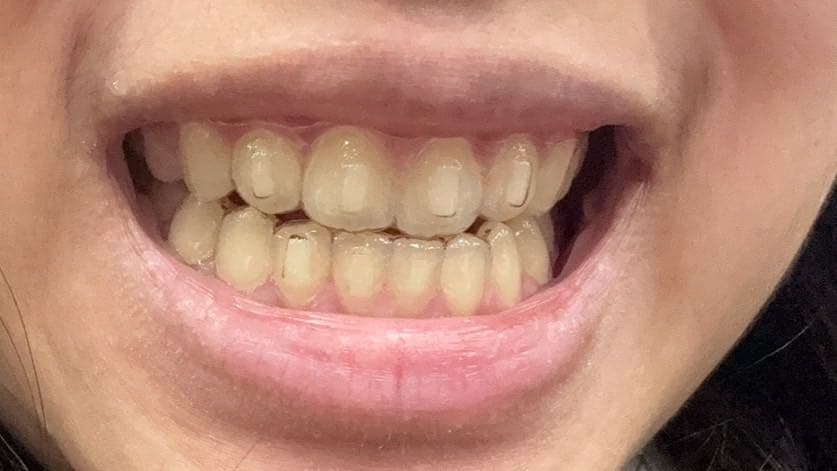 我終於敢笑了😆⋯⋯女大十八變🪄 - 蘿伊 (@zoey__eat) | Dcard