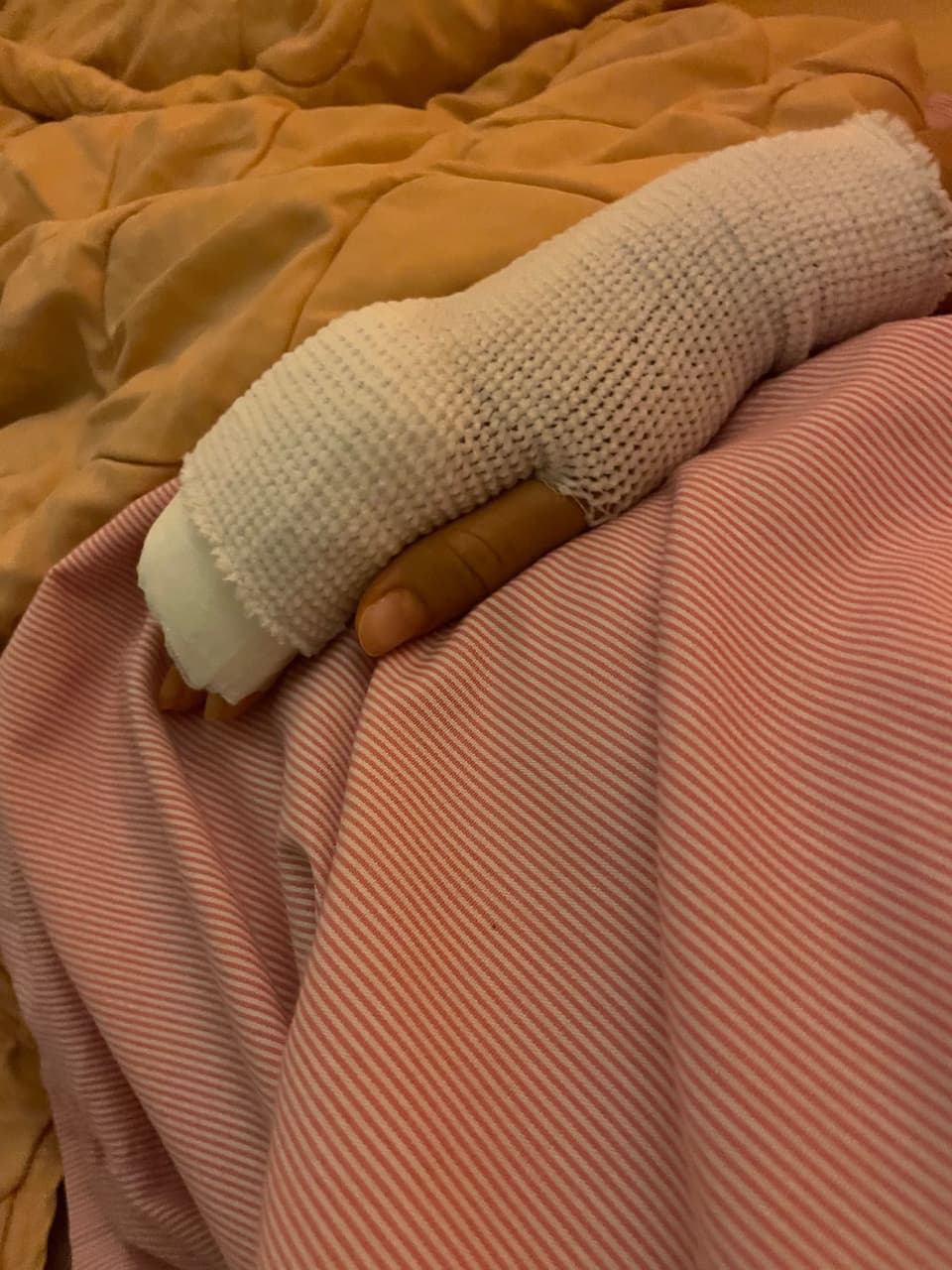 開刀初體驗-骨腫瘤 - 媽媽咪呀的咪呀 (@miapu________) | Dcard