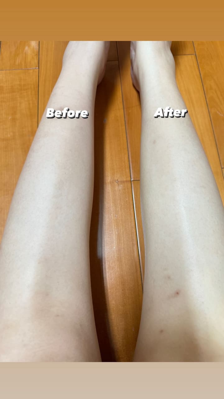 乾癢脫皮bye👋🏻滑嫩肌膚hi - 贊助板 | Dcard