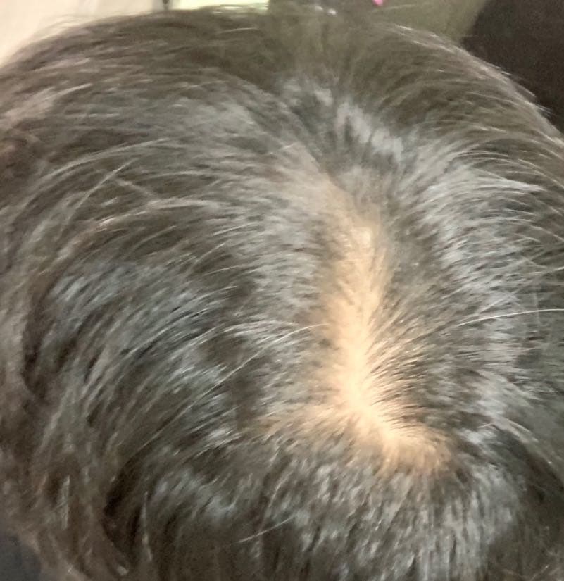 抗戰禿頭紀錄 - B14 留言 | Dcard