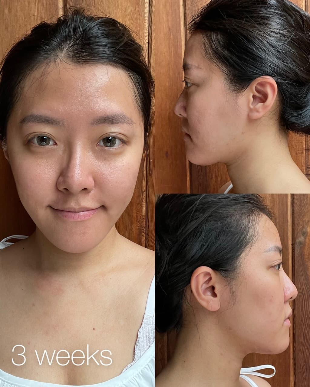 #分享 終於找回我的輪廓線 雙下巴消失全紀錄!! - 狂愛日本的女紙 (@der0311) | Dcard