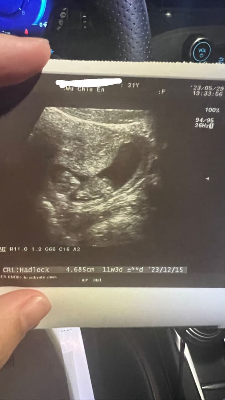 #懷孕 寶寶更新～ - 親子板 | Dcard