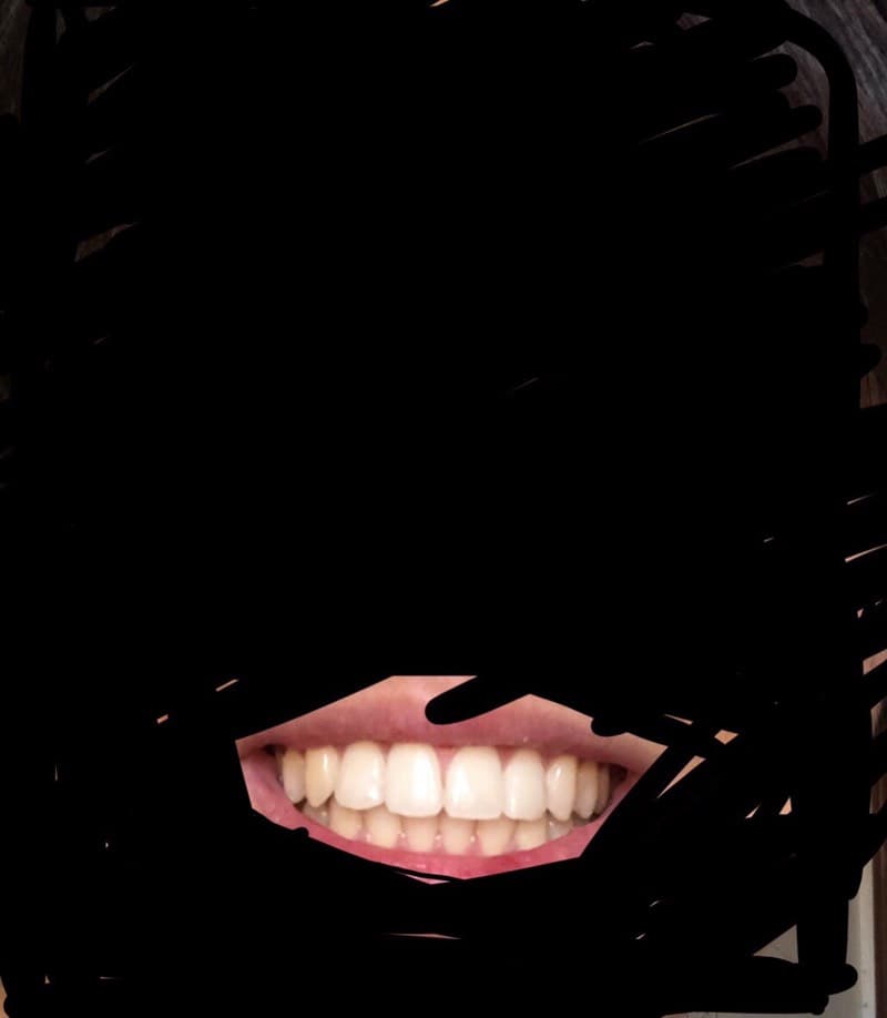 關於牙齒矯正該知道的事(文超長請注意） - B115 留言 | Dcard