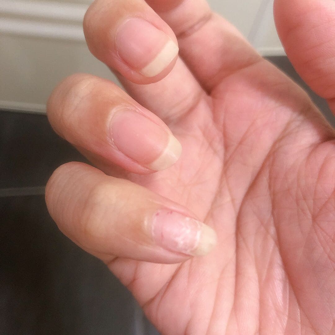 問題 詢問美甲掀起來的原因 美甲板 Dcard