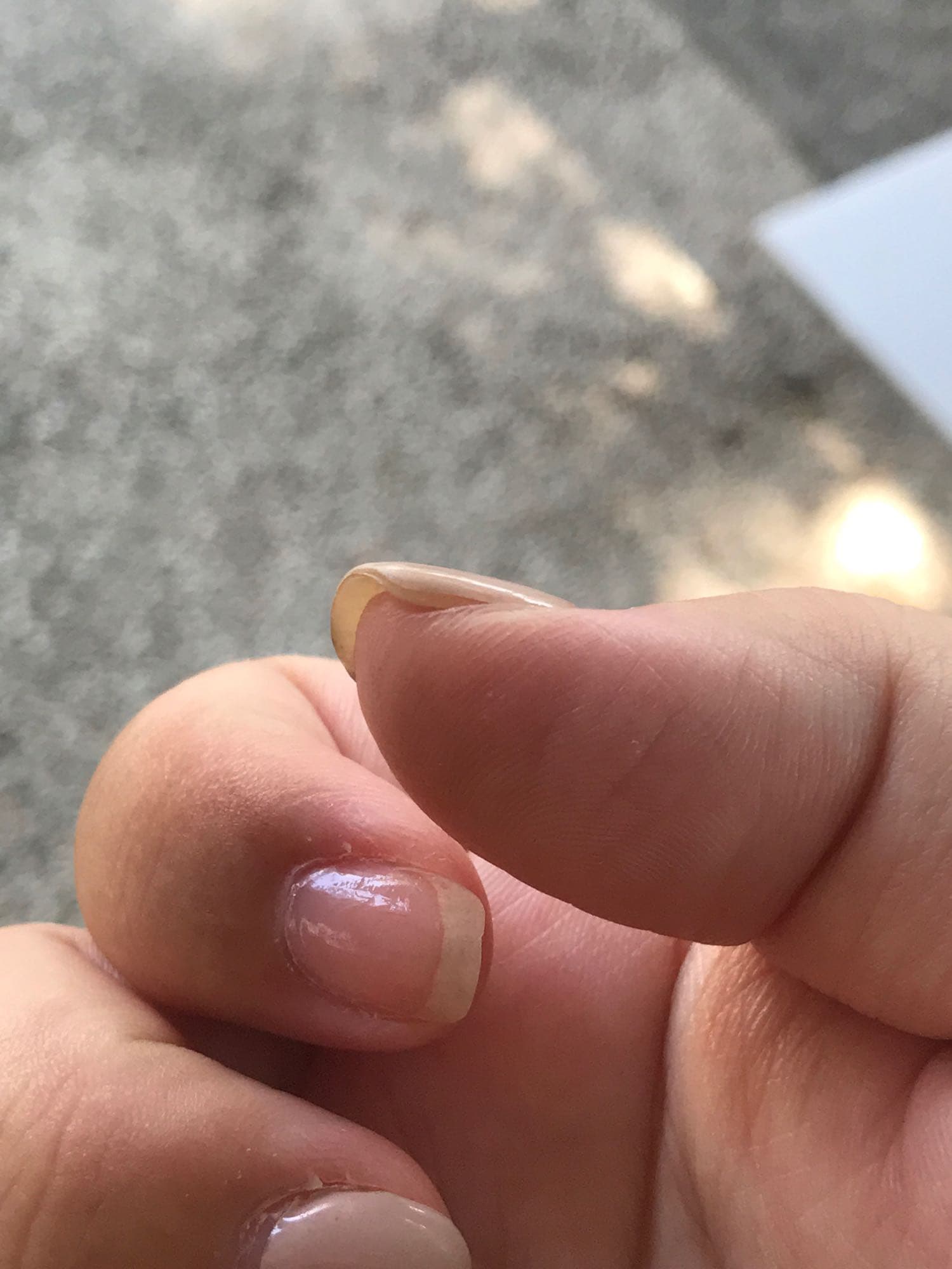 問題 問題 凝膠指甲起翹 美甲板 Dcard