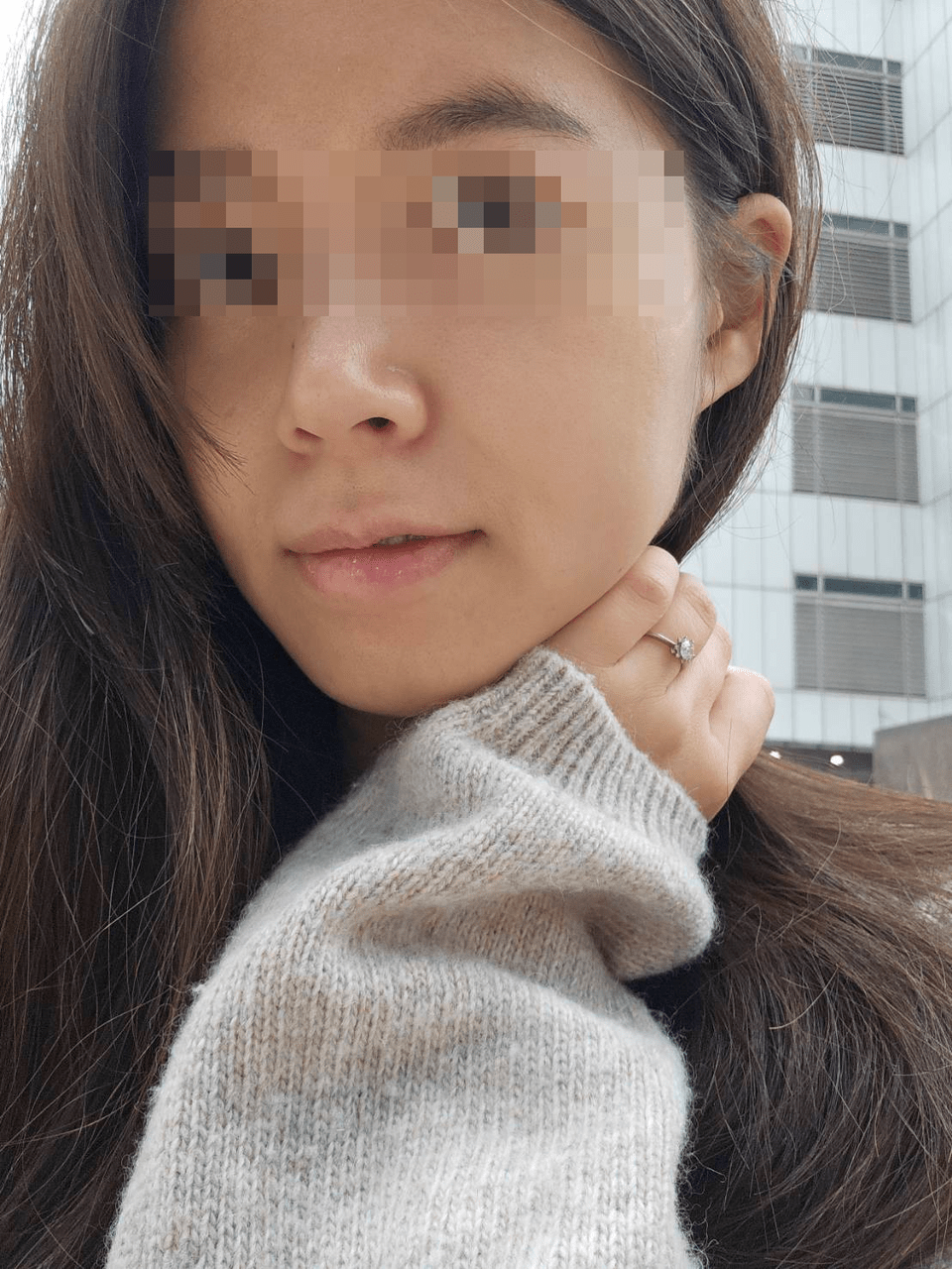 #分享 Z音波術後兩個月分享 - 醫美板 | Dcard