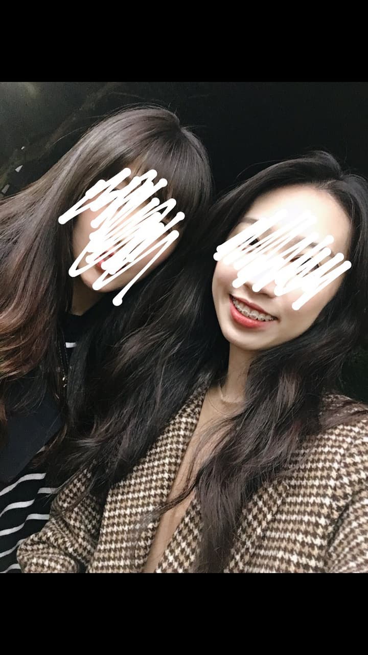 矯正牙齒全記錄！ - B83 留言 | Dcard