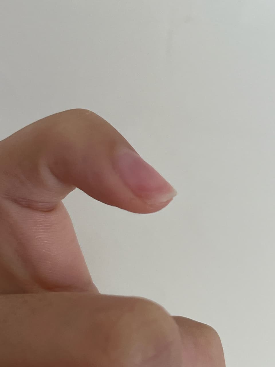 問題 想請問這樣是過度卸甲嗎跟解決方法