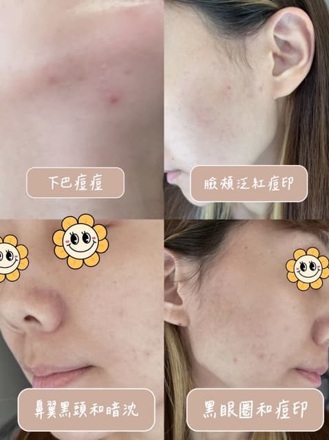 曾經我也有過容貌焦慮,但現在我克服了🌞🌞🌞 美妝板 Dcard