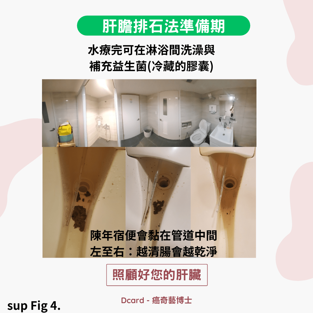 肝膽排石法的3次實際體驗過程與心得(文長，有屎照) - 癌奇藝博士 (@gd810424) | Dcard