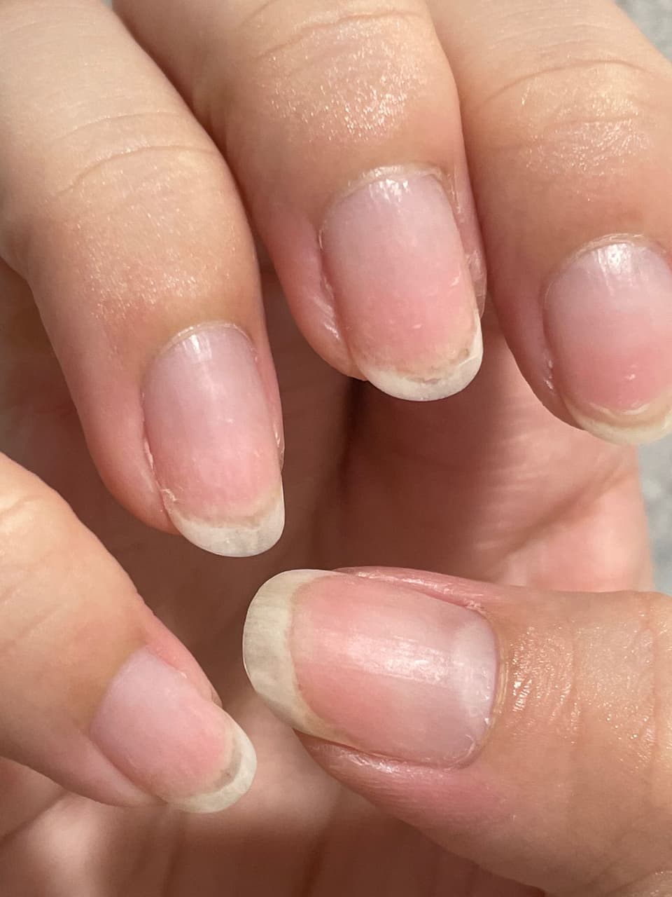 問題 卸完甲這樣正常嗎? 美甲板 Dcard
