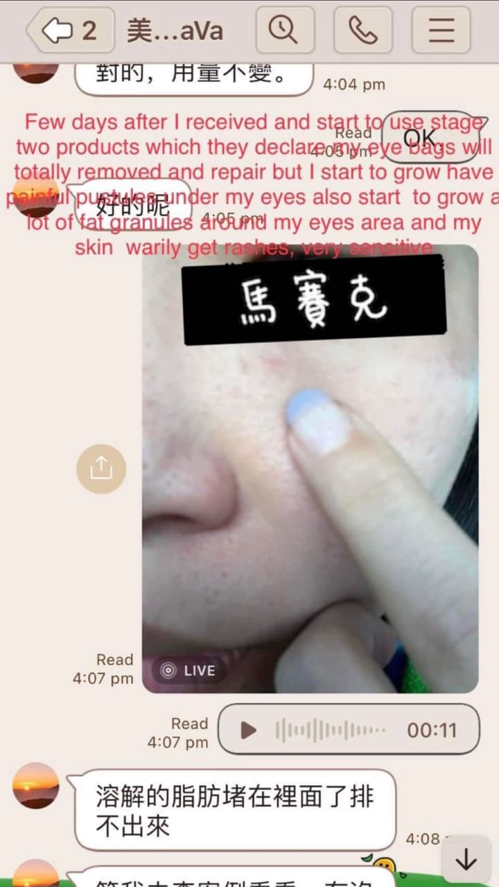 千萬不要輕易相信FB的廣告-Alice肌膚研究院 - 網路購物板 | Dcard