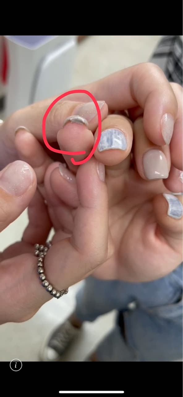 問題 問題 光療指甲包邊脫落是正常的嗎? 美甲板 Dcard