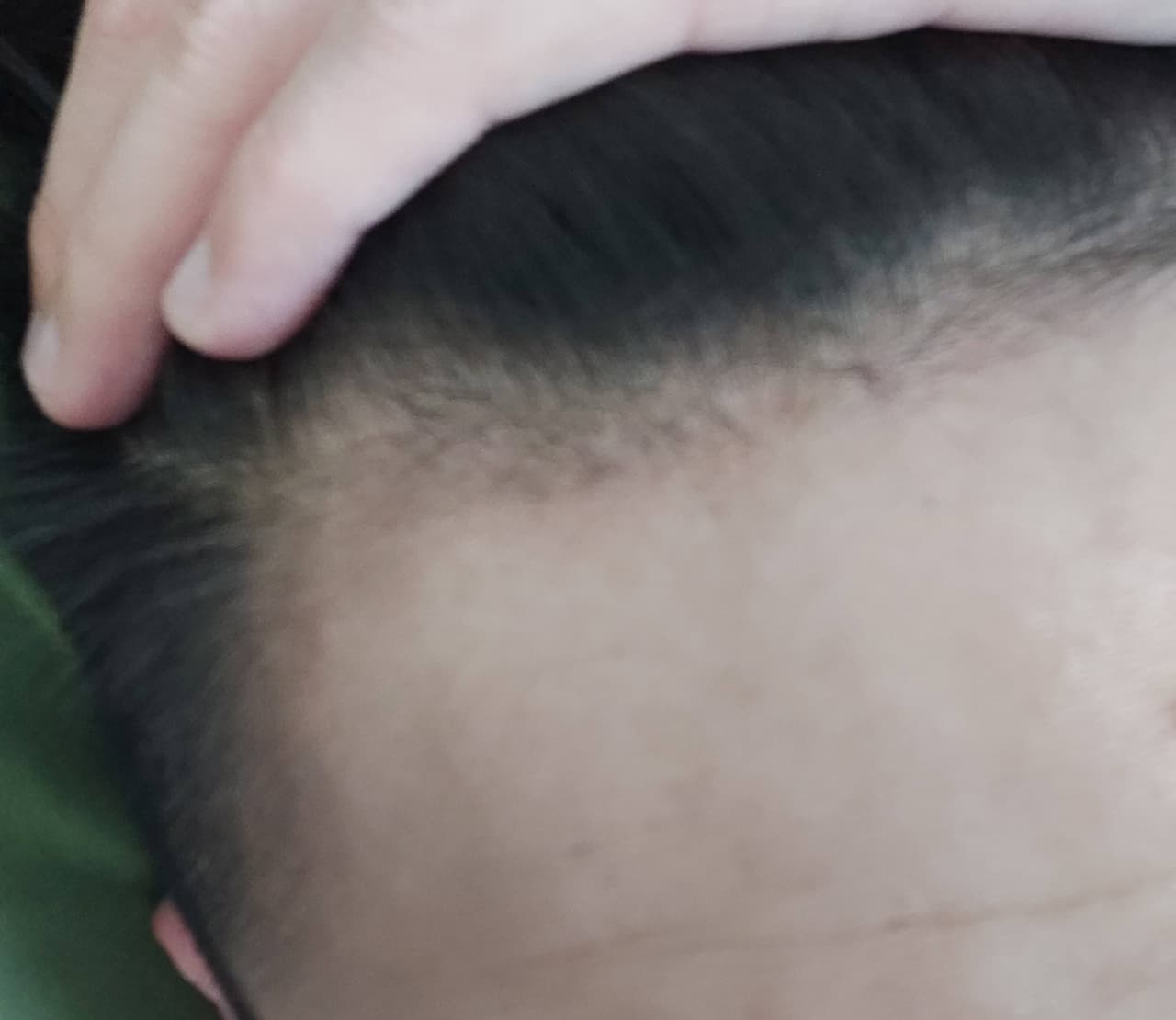 雄性禿抗禿 - B116 留言 | Dcard