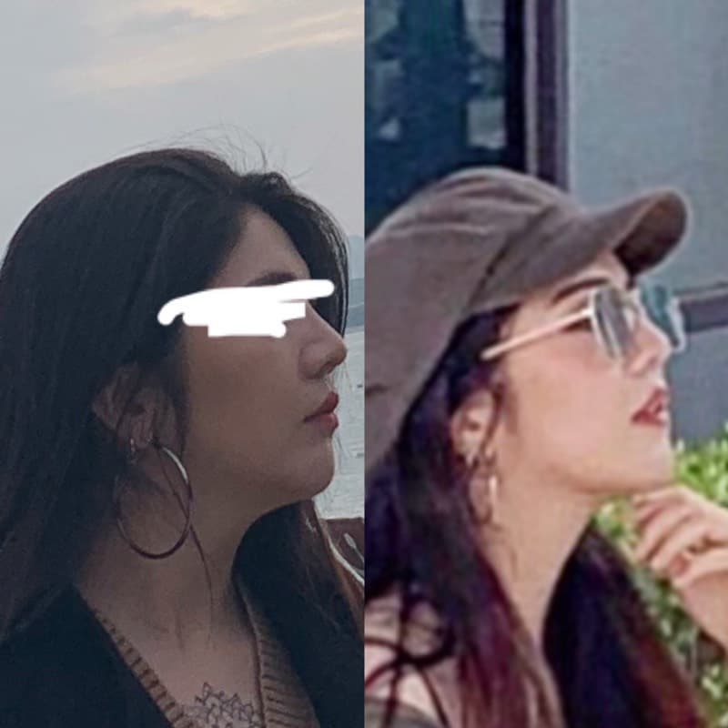 #二更 圖 消脂針雙下巴 - B61 留言 | Dcard