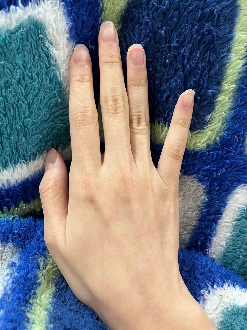 問題 手指變形能做美甲嗎 美甲板 Dcard