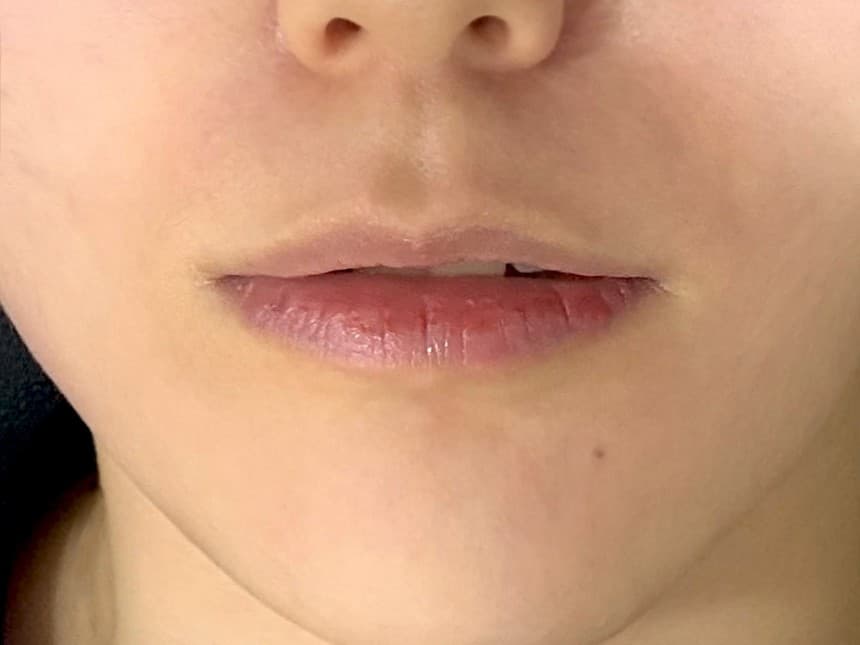 #分享 打了理想中的微笑唇！ - B66 留言 | Dcard