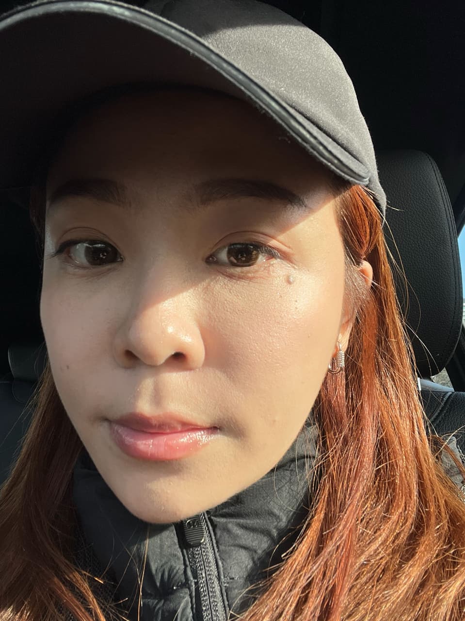 我的第一次水光針心得💦（有血慎入） #肝苦世代 - 自由媳 (@freeee_na) | Dcard