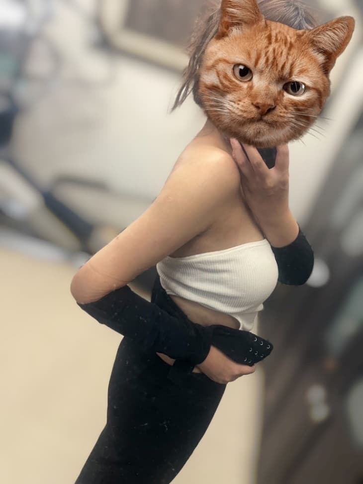 #分享 手臂抽脂 不是天生完美，但我想讓自己更接近理想 - 晶美整形 (@skin1000) | Dcard