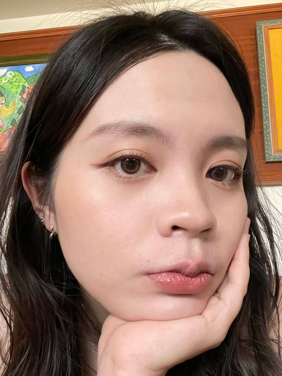 【新竹皮秒推薦】超蘇胡的醫美體驗😍 &新竹一日遊心得 - Jane ️‍🔥🌷💸 (@buy13uy___jane) | Dcard