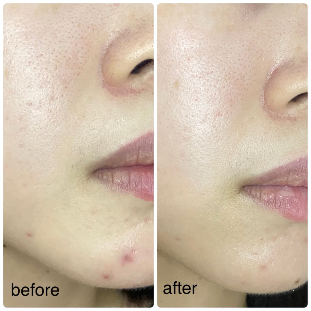 簡單保養Simplism 藏紅花修復乳霜 升級版！文末抽獎🎁 (已抽出）#真心話大告白 - 伯爵奶茶🥤 (@cat888) | Dcard