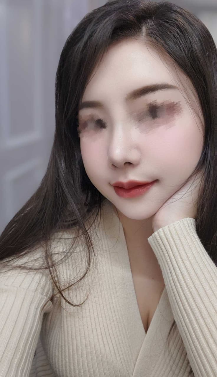 花了300萬整形的人生 - 女孩板 | Dcard