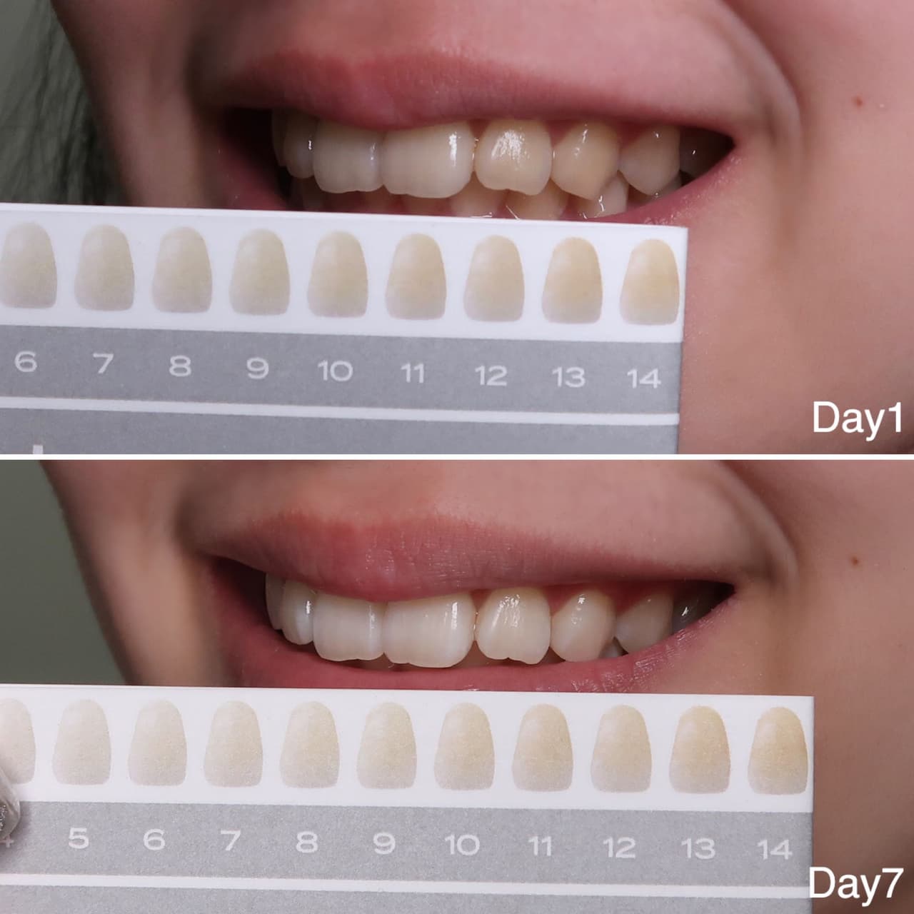 用完能繼續咬冰棒的居家美白牙齒🦷 Lab52齒妍堂 美白抗染雙效組合 #開箱大使 - 美妝板 | Dcard