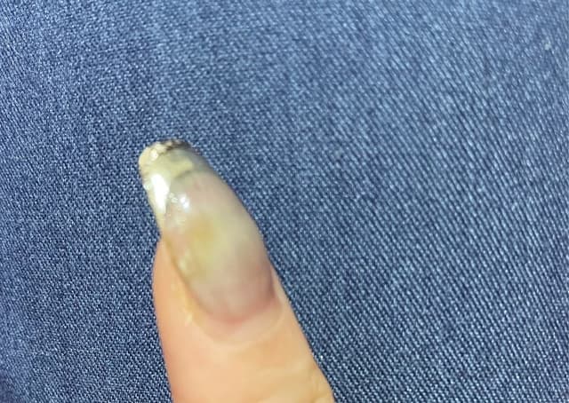 竟然還有偽裝版的發霉指甲 美甲板 Dcard
