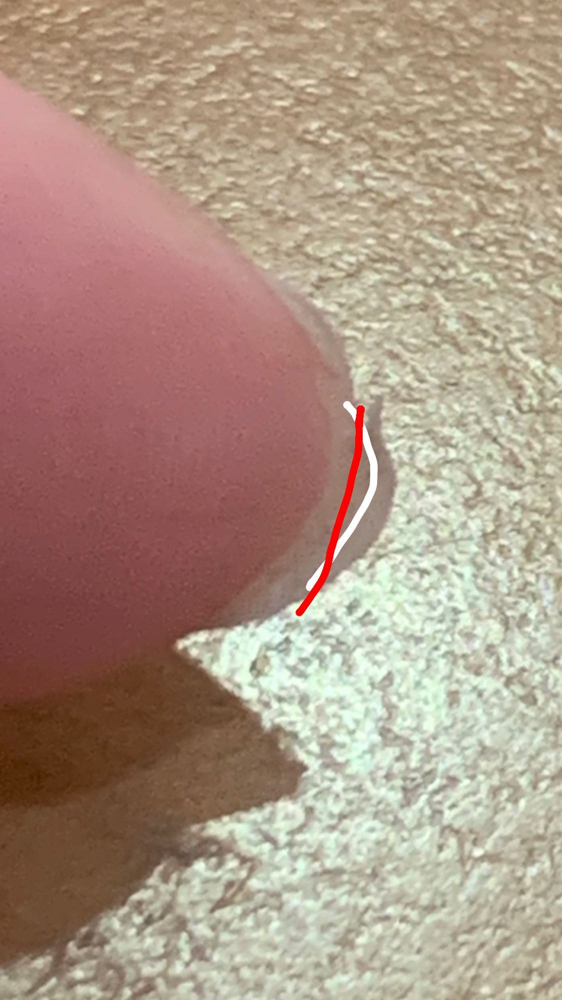 問題 指甲裂掉但是連著指尖的肉不能直接剪掉 美甲板 Dcard