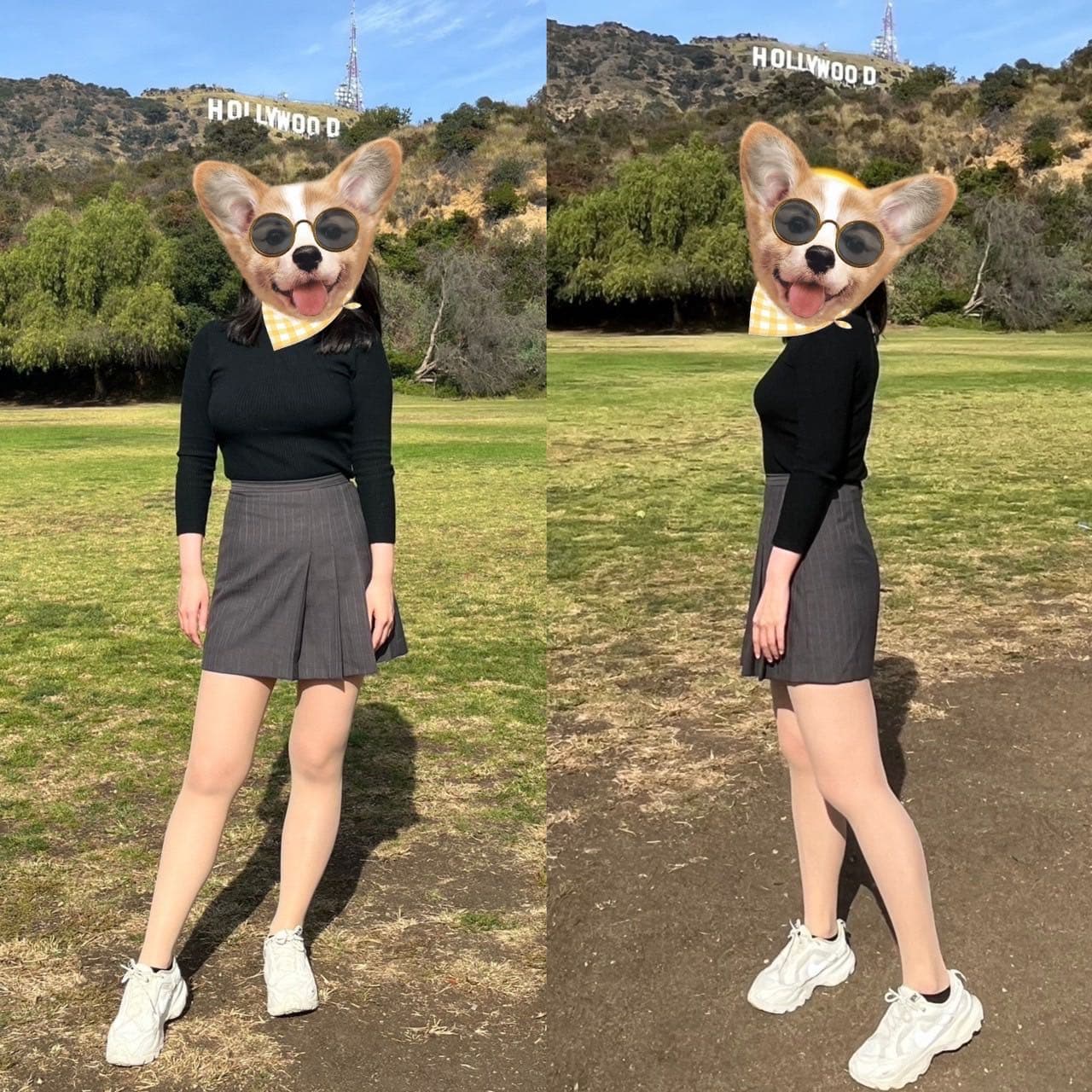 #分享 超有感的大小腿抽脂&PRP補胸 part 1 - 醫美板 | Dcard