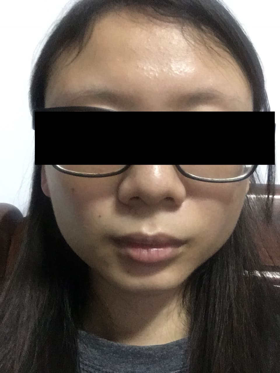 拔智齒臉型變了！？ - B17 留言 | Dcard