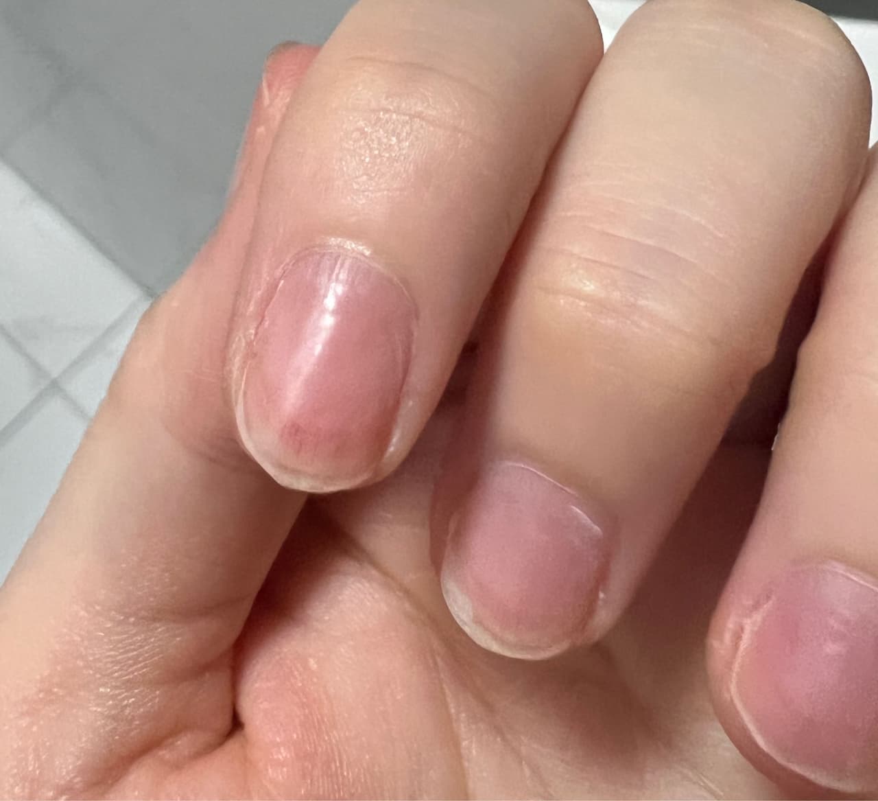 問題 卸甲後的狀況 美甲板 Dcard