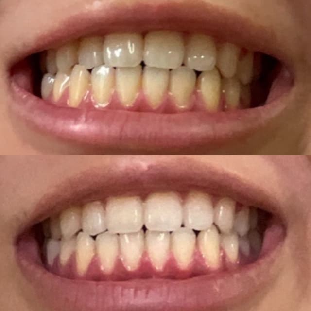 黃牙得救了！！！ - B123 留言 | Dcard