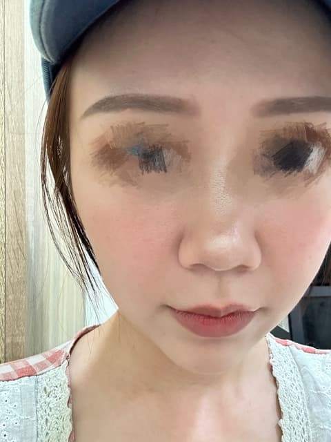 #分享 第一次體驗Z音波～～法令紋out!! - 醫美板 | Dcard