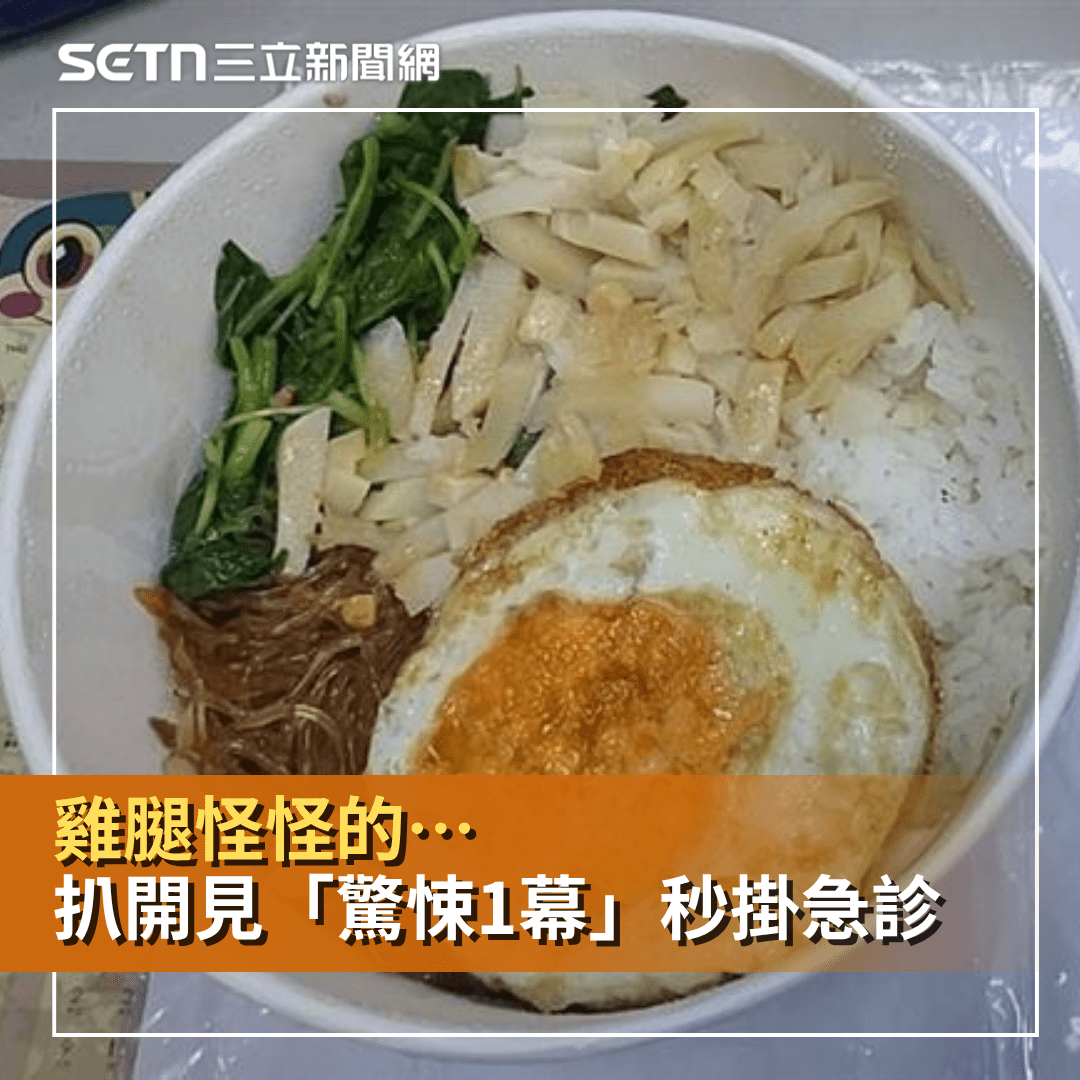 咬下去怪怪的…雞腿皮一扒開見「驚悚1幕」 他秒帶妻掛急診 - SETN三立新聞網 (@setn54) | Dcard