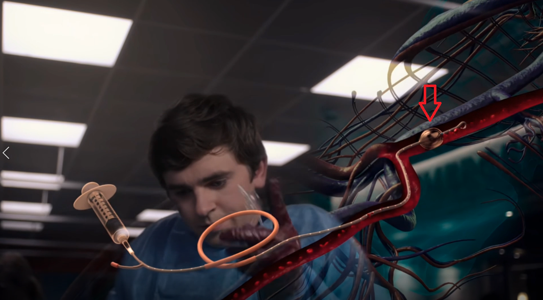 《浪漫醫生金師傅3》EP9、10醫學討論(微雷) - 戲劇綜藝板 | Dcard