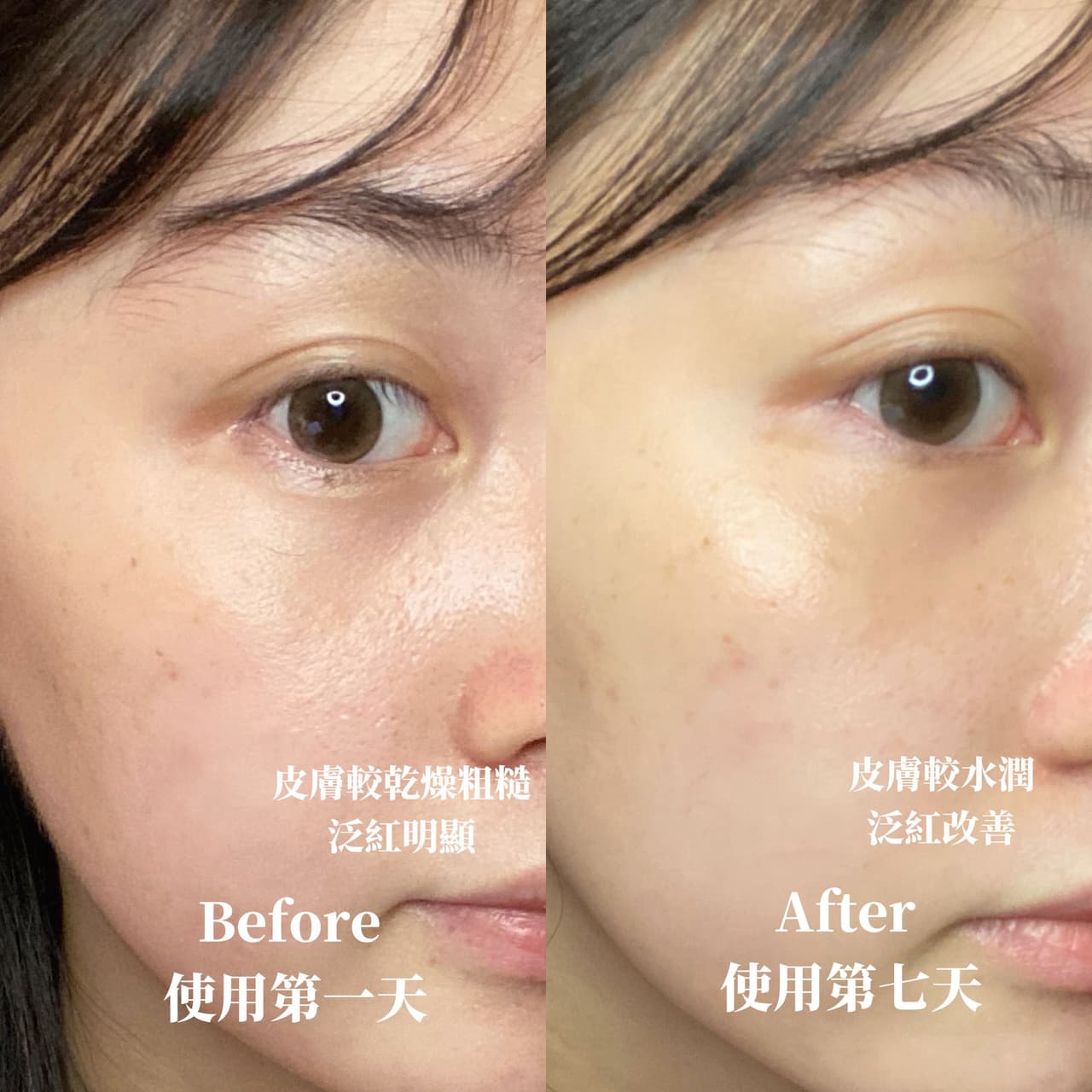 INFP每天睡前給自己的療癒護膚儀式🌛⑅୨୧⑅*⑅୨୧ - 小勺🐰 (@rabbitinthehole) | Dcard