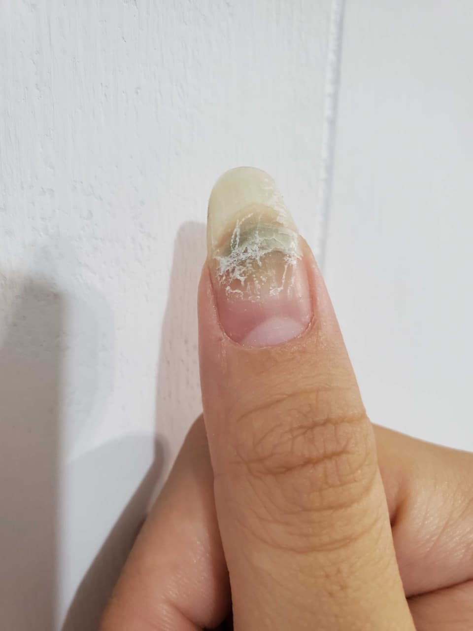 黑特 問題黑特 掉甲發霉可以怎麼做？ 美甲板 Dcard