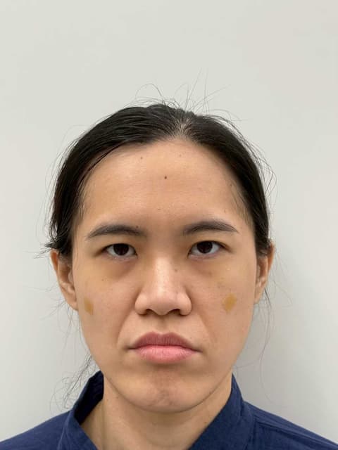 #分享 想要雙眼皮卻變成去拉皮XD - B26 留言 | Dcard